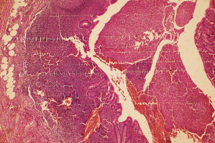 Ever Heard Of Digestive Plaque? | BIOHM Health